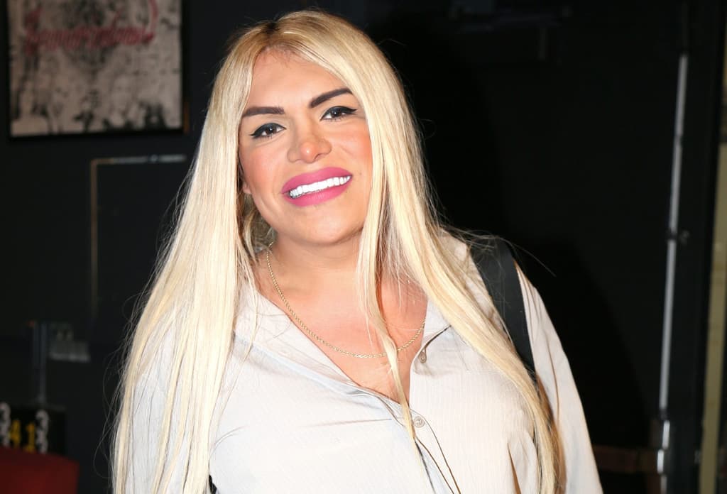 Wendy Guevara muestra su cambio físico tras la cirugía estética a la ...
