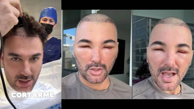 Actor de ‘Corazón Indomable’ aparece con el rostro desfigurado: destapa ...