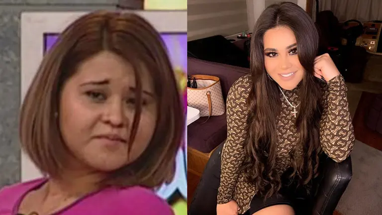 La radical transformación de Gomita tras cirugías de nariz, busto y ...