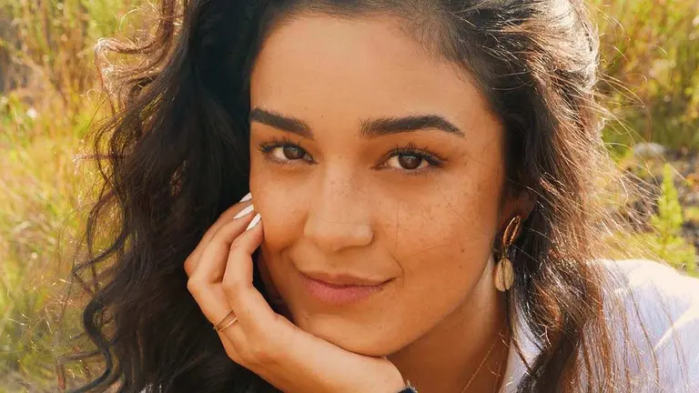 Alejandra, hija de Biby Gaytán, deja ver la quemadura que sufrió en la ...