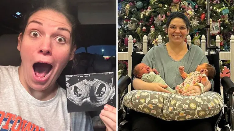 ¿Qué es el útero didelfo? Mujer con 'dos úteros' da a luz a gemelas en ...