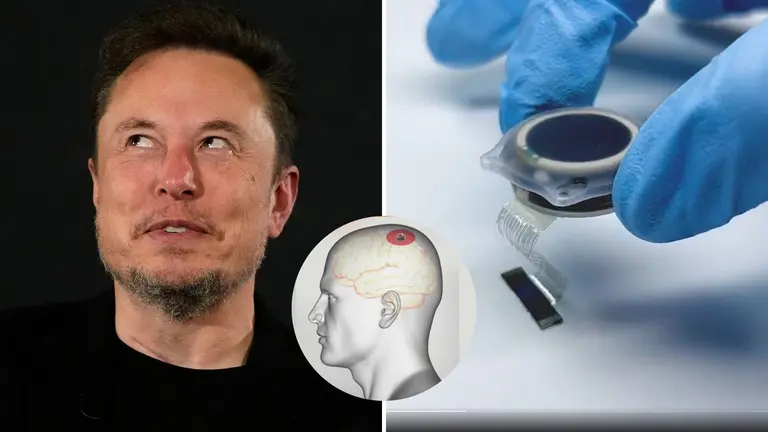 Qué Hace El Chip De Elon Musk Así Funciona El Primer Implante De Chip