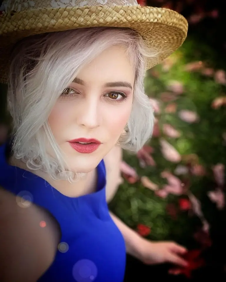 Allisson Lozz: ¿qué padece y por qué preocupó a sus fans? | Shows ...