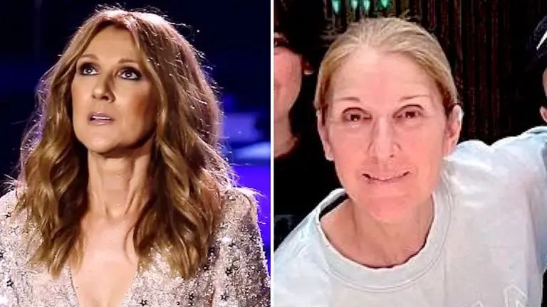Céline Dion ya perdió el control de sus músculos debido a su enfermedad ...