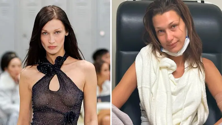 ¿Qué le pasó a Bella Hadid? Por fin habló de la enfermedad que la tenía ...