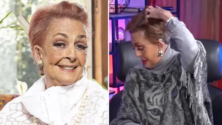 Talina Fernández tenía 2 tumores en la cabeza: quedó pasmada al ver el ...