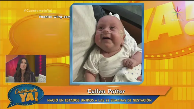 HISTORIA DE LA RED: Bebé nace a las 22 semanas de gestación | Shows ...