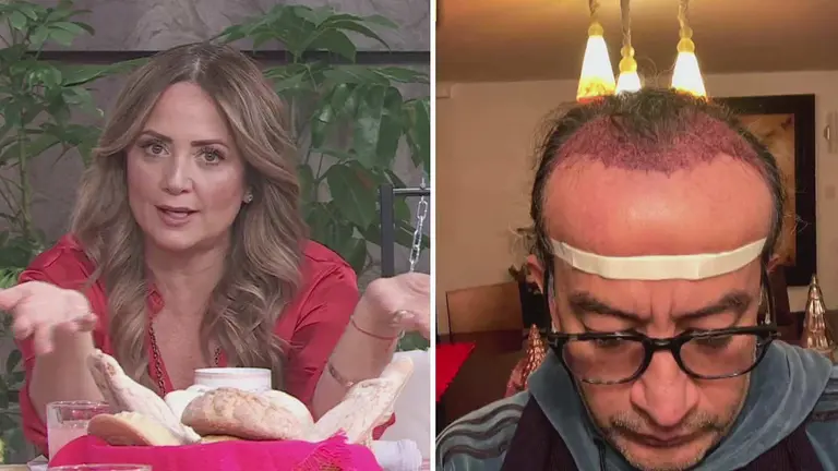 Germán Ortega se somete a injerto capilar y Andrea Legarreta lo ...