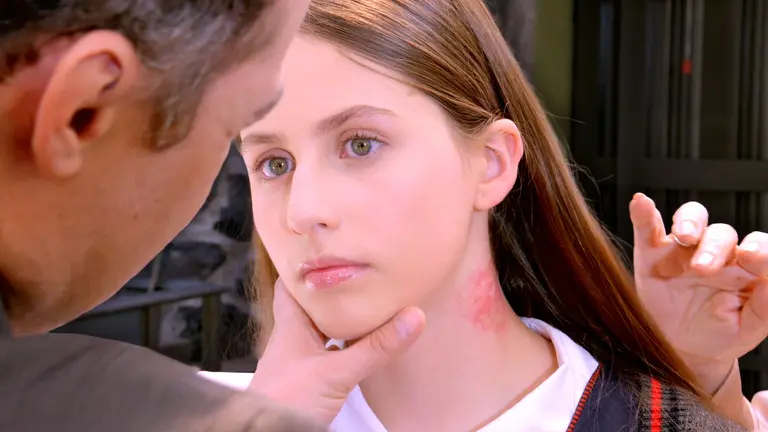 La Rosa de Guadalupe: Capítulo completo "La urticaria" | Shows La Rosa de Guadalupe | Las Estrellas