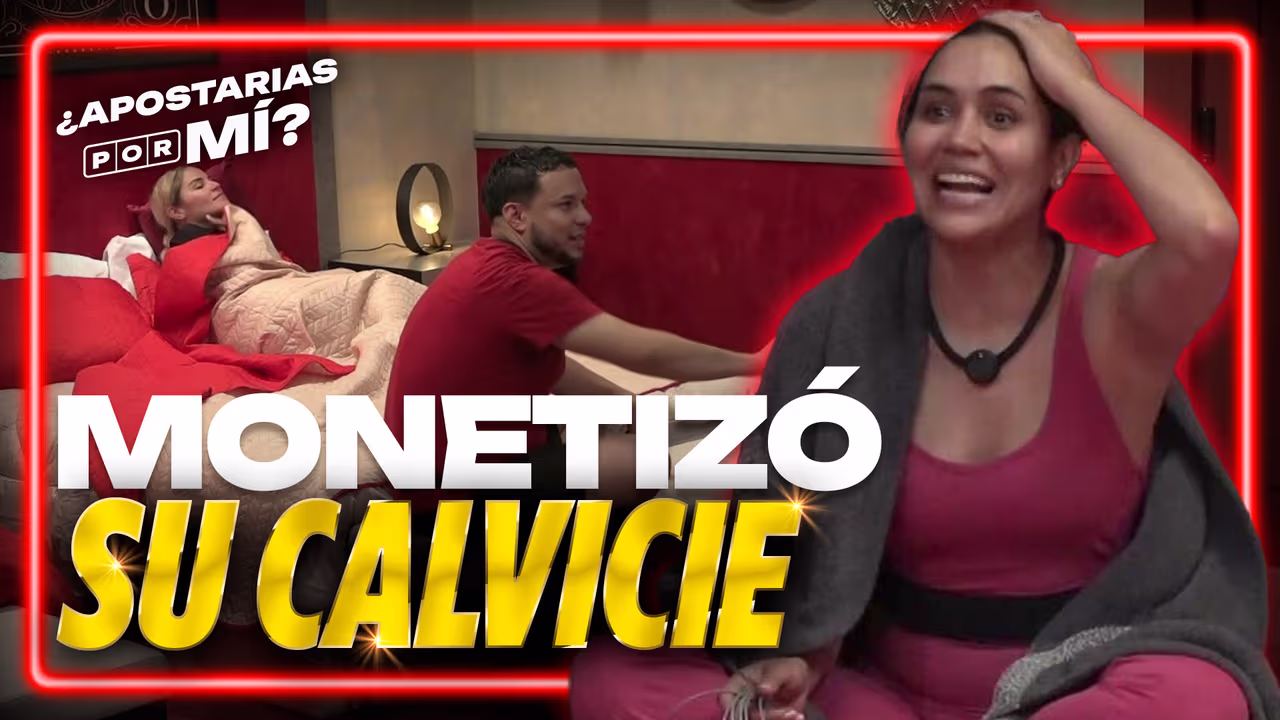 Tiby se estaba quedando calva por el estrés pero supo facturar su ...